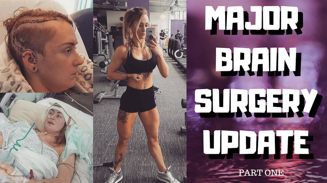 3 Year post BRAIN SURGERY Update | Brain AVM | Pt1 - YouTube