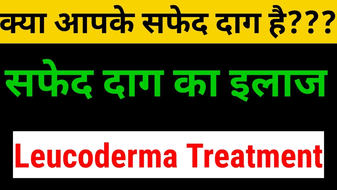 white patches, leucoderma ka treatment,safed daag ka ilaj, #shorts ...