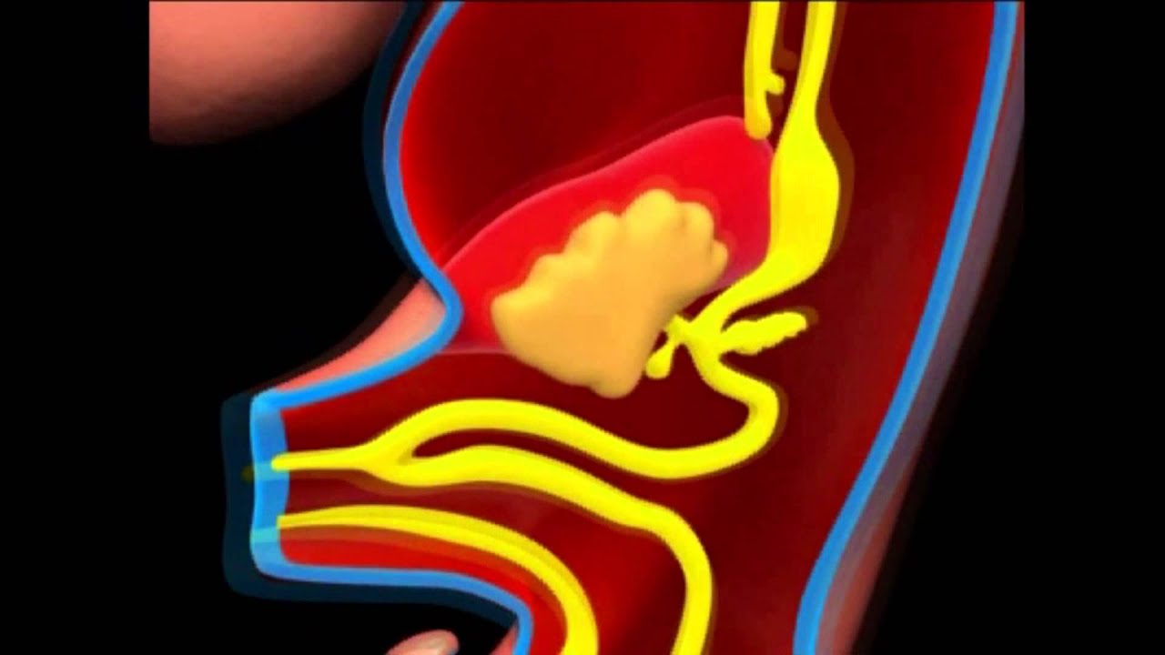 desarrollo embrionario del tubo digestivo - YouTube