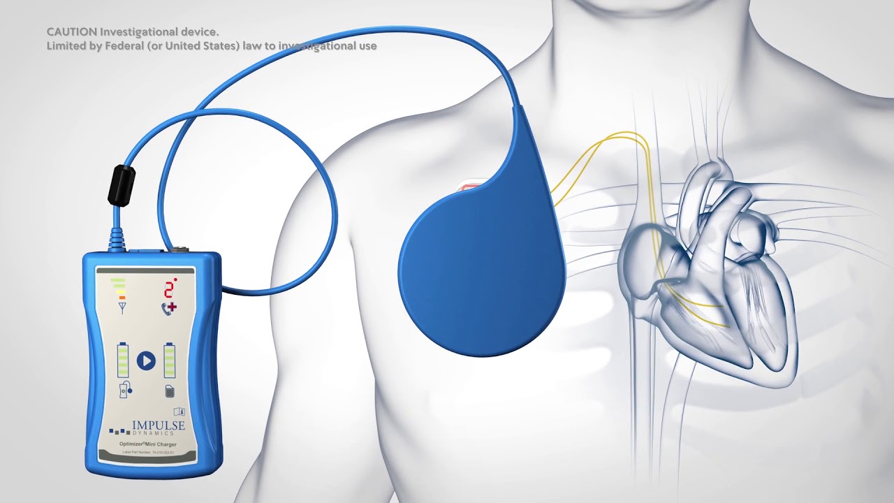 CCM Optimizer from Impulse Dynamics - YouTube