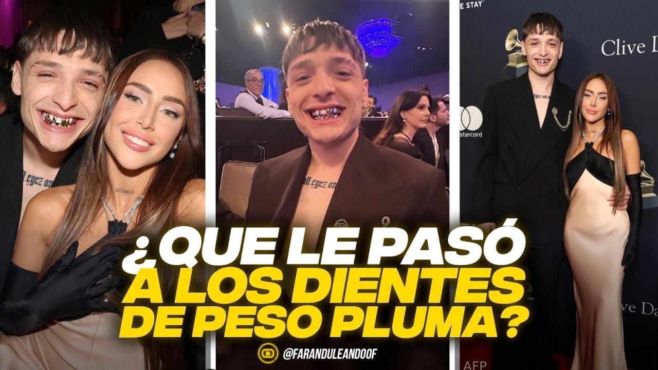 QUE LE PASÓ A LOS DIENTES DE PESÓ PLUMA. - YouTube