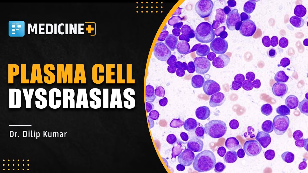 Plasma Cell Dyscrasias by Dr. Dilip kumar - PrepLadder | NEET SS - YouTube