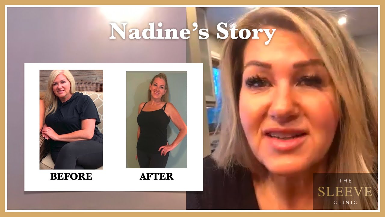 Nadine’s Journey To Losing 56 lbs With The Sleeve Clinic - YouTube