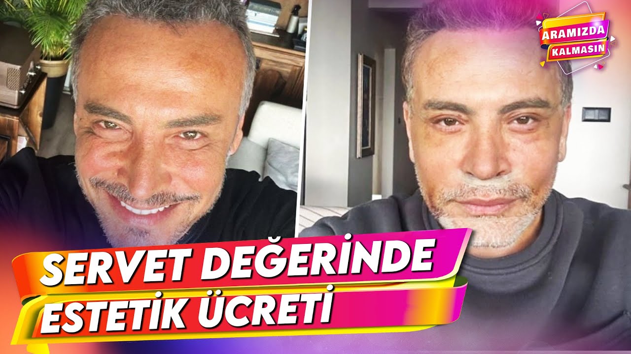 Cenk Eren'in Estetik Macerasının Detayları | Aramızda Kalmasın 59 ...