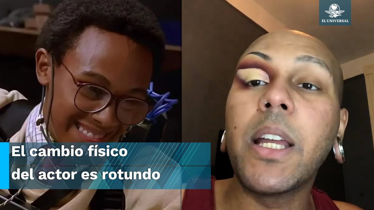 Así luce Craig Lamar, actor que dio vida a Stevie Kenarban en “Malcolm ...