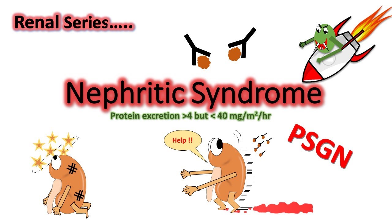 Nephritic Syndrome | PSGN | Pathophysiology , Clinical Features ...