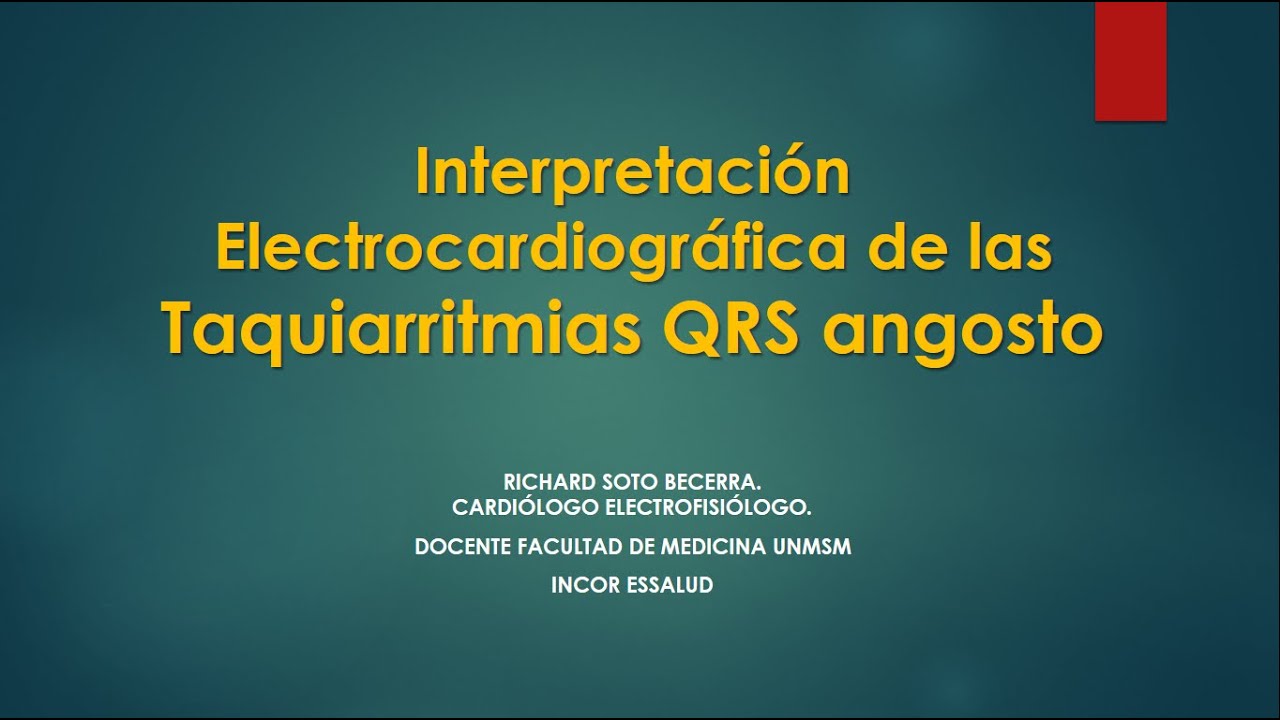 SESIÓN 9 TAQUIARRITMIA QRS ANGOSTO - YouTube