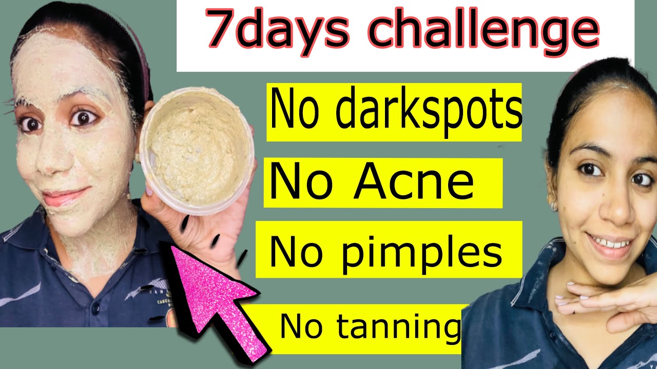 No pimples,acne & dark spots in summers ☀️| use this diy face mask for ...