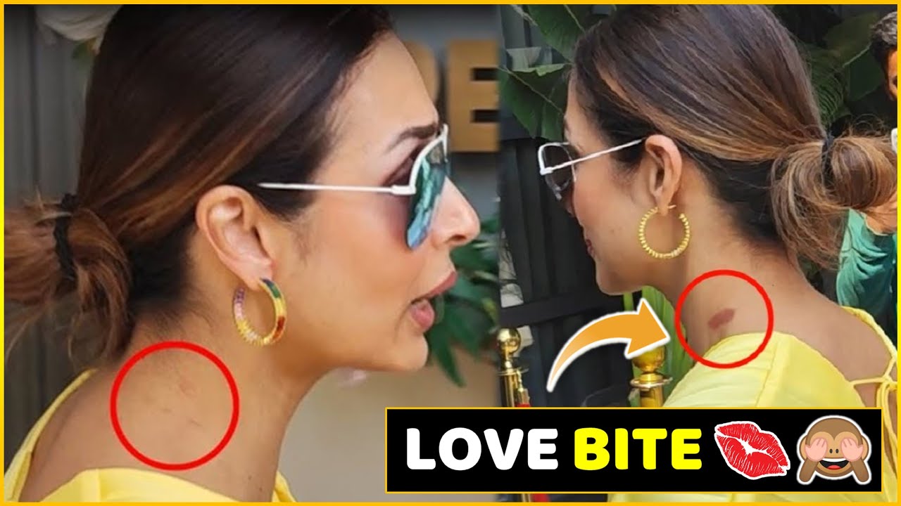 Malaika Arora Khan Caught With Love Bites On Her Neck 💋 By Boyfriend ...