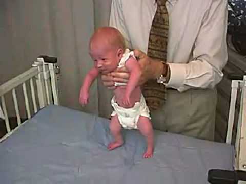 neurology exam: newborn-abnormal: Positions - Vertical Suspension - YouTube