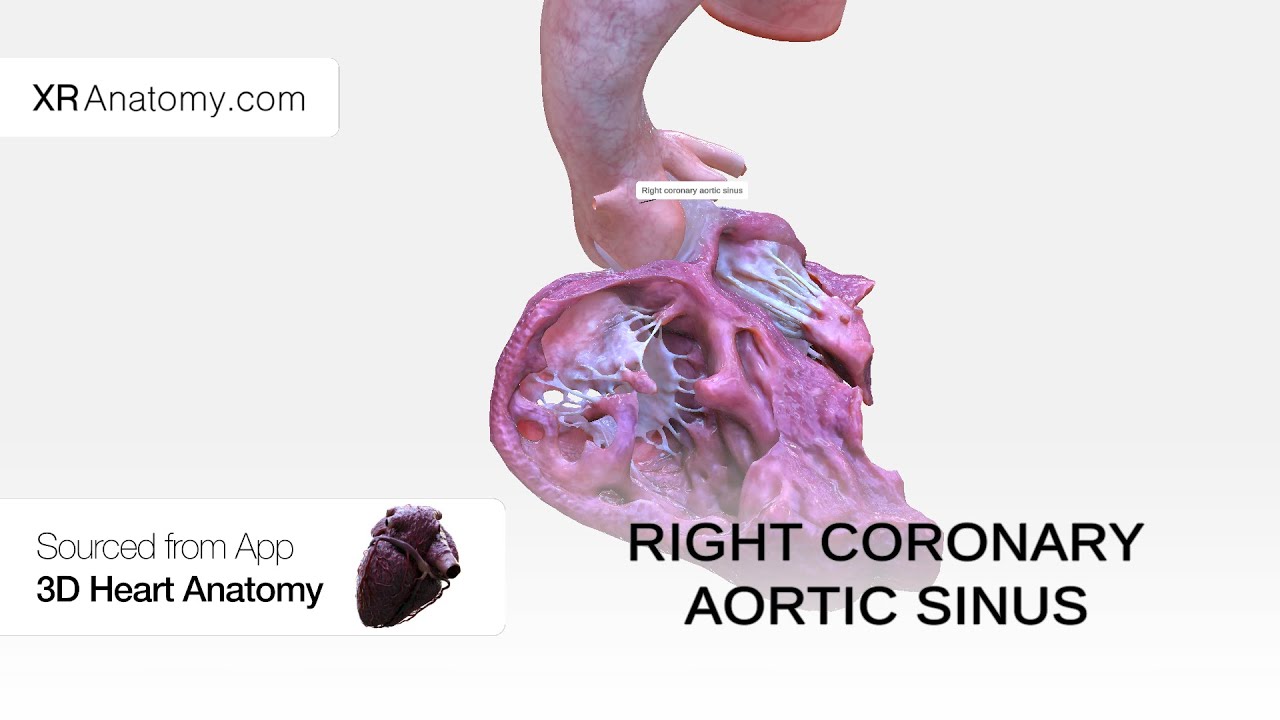 Right coronary aortic sinus - YouTube
