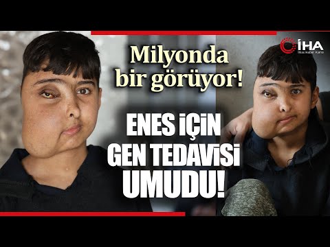 Yüzündeki Kitle Nedeniyle İki Yüzü Varmış Gibi Görünen Enes Sağlığına Kavuşacak