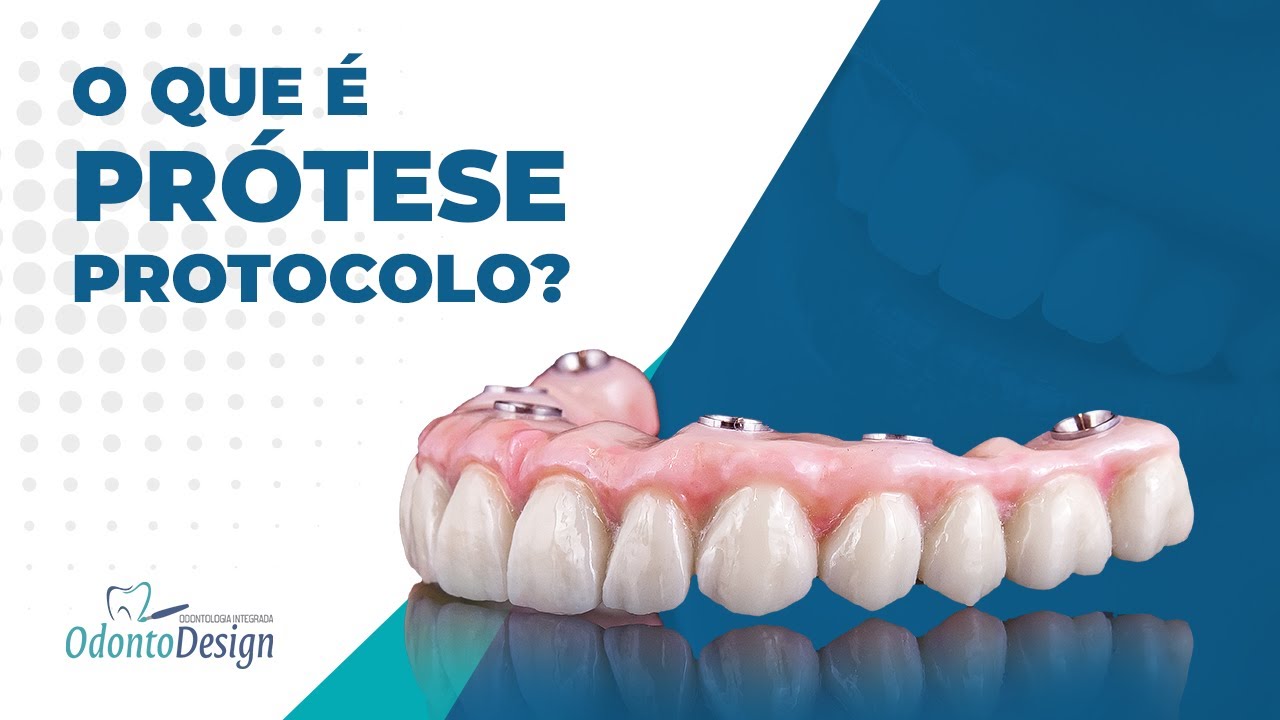 O QUE É PRÓTESE PROTOCOLO? - YouTube