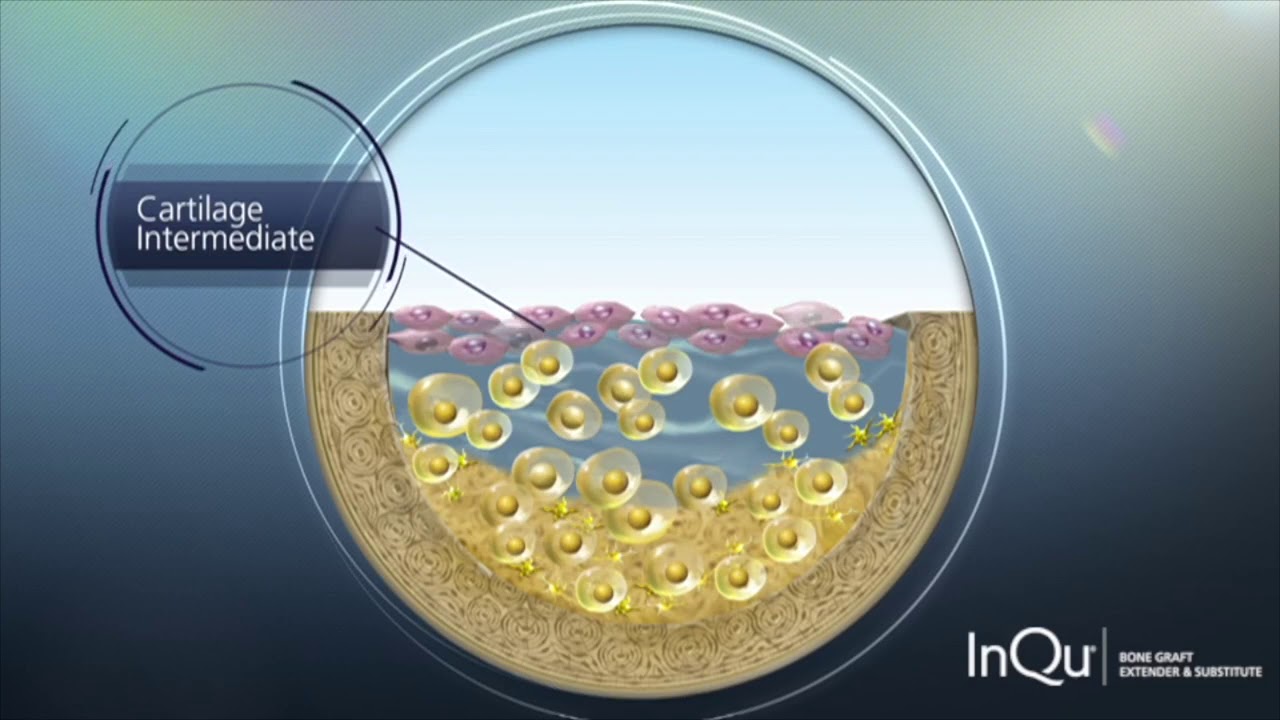 InQu® Bone Graft Extender and Substitute Bone Formation - YouTube