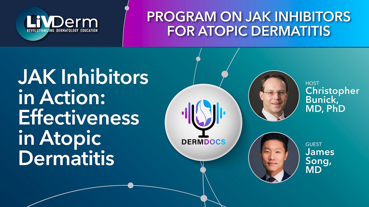 JAK Inhibitors in Action: Effectiveness in Atopic Dermatitis - YouTube