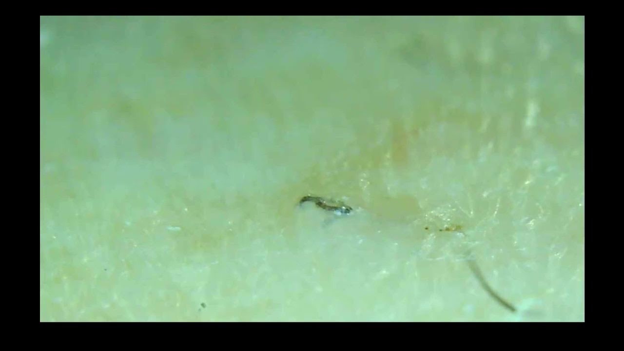 The BEST Live Plucking!! - YouTube