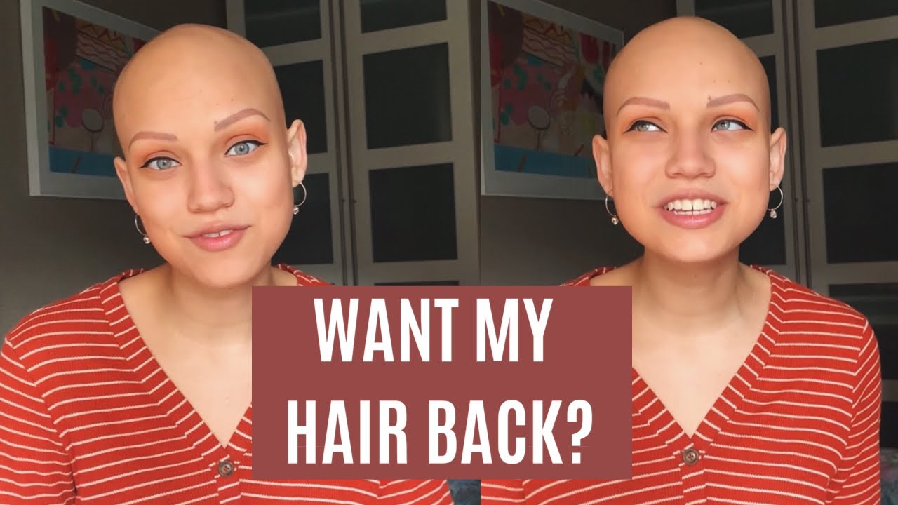DO I WANT MY HAIR BACK | what being bald means to me - YouTube