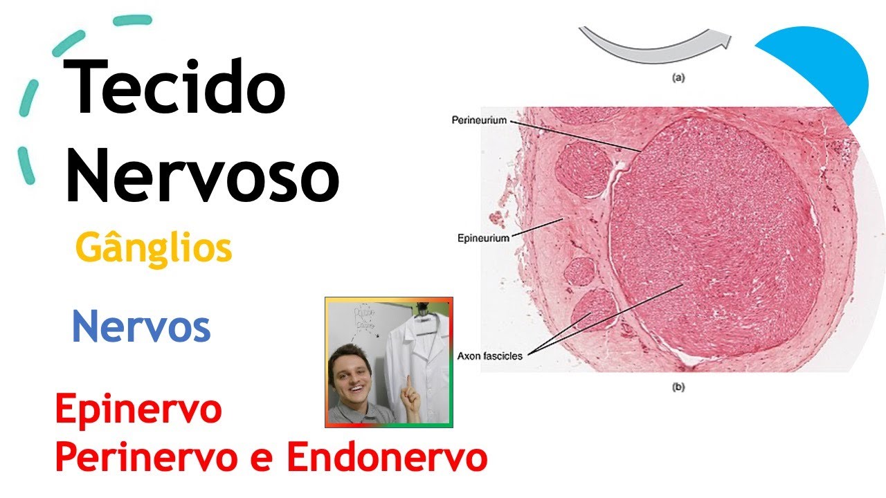 Tecido Nervoso (Nervos: Epinervo , Perinervo e Endovervo) (Gânglios ...