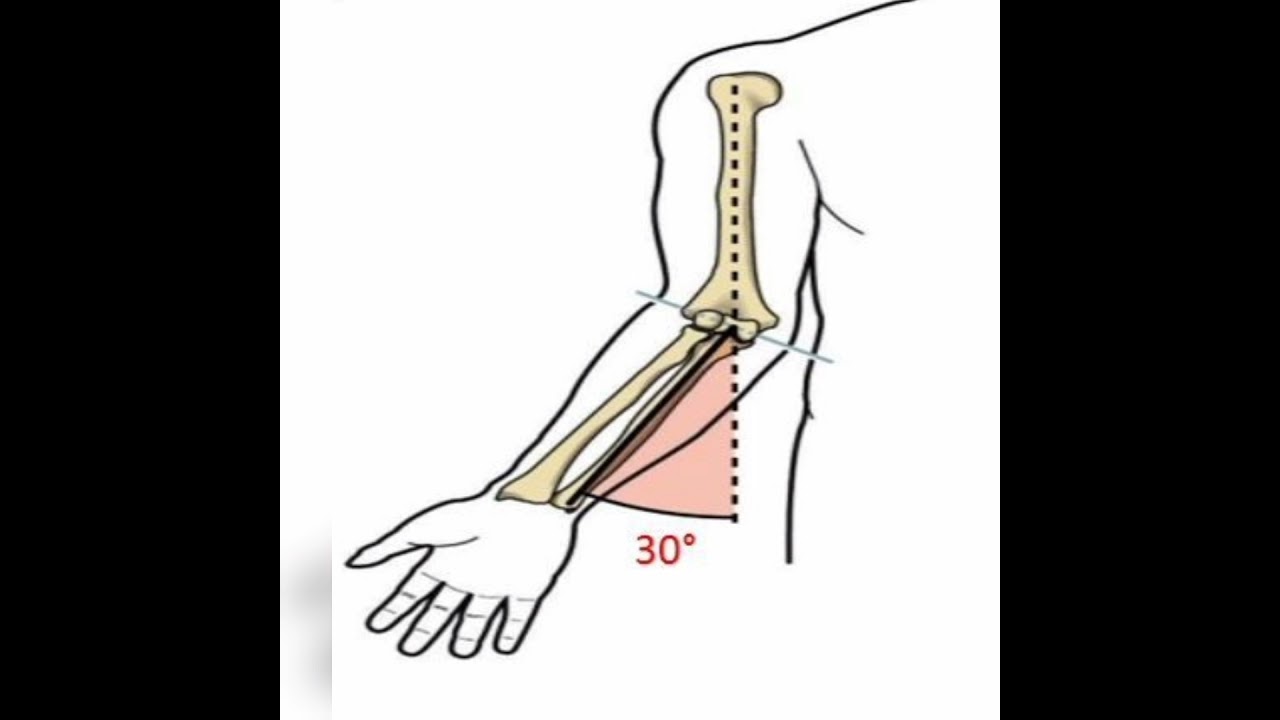 Prueba de esfuerzo en valgo y varo de codo- Maryi Lozada - YouTube