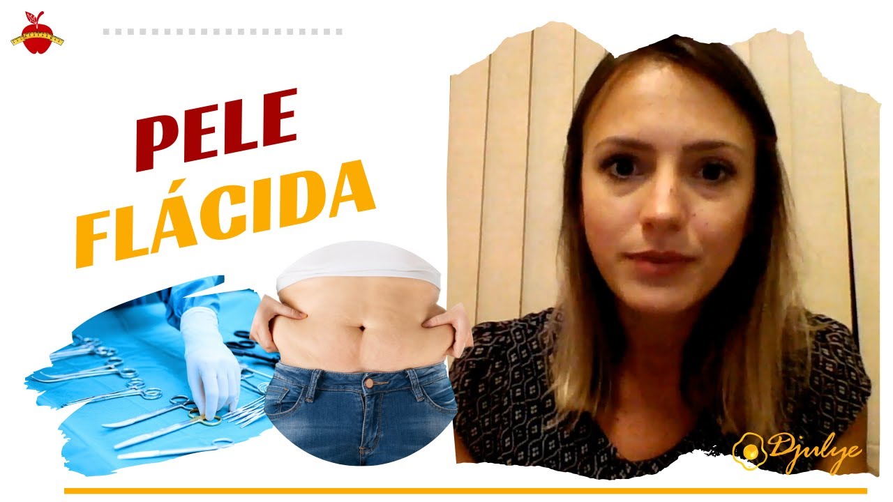 COMO LIDAR COM A PELE FLÁCIDA DEPOIS DE PERDER PESO? | Djulye - YouTube