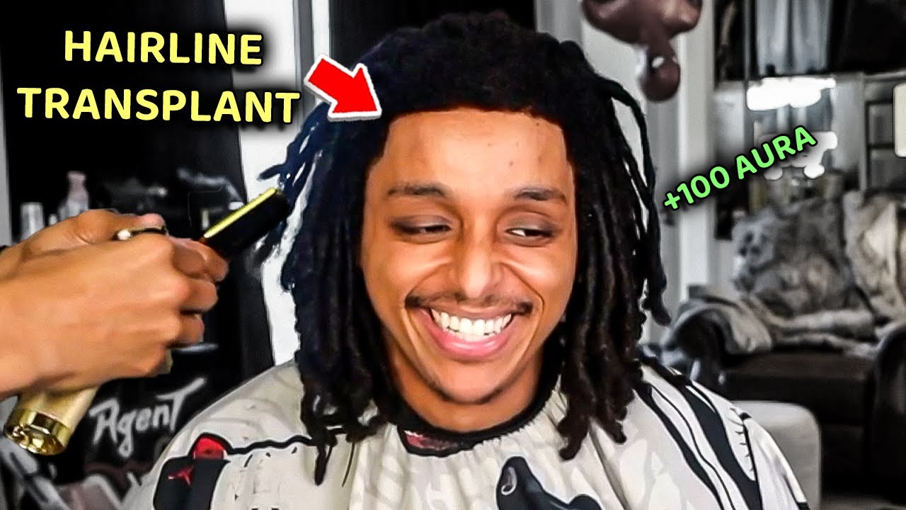 AGENT GETS HAIRLINE SURGERY ON STREAM - YouTube
