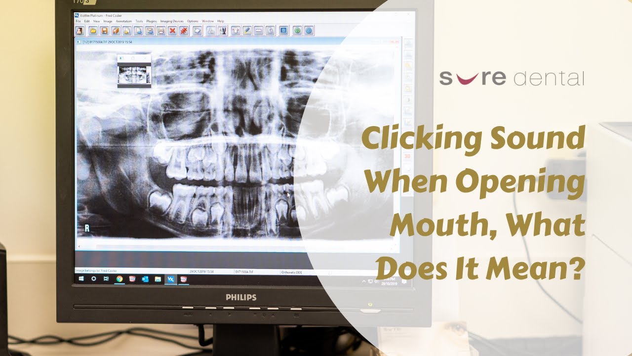 Clicking Sound When Opening Mouth, What Does It Mean - YouTube