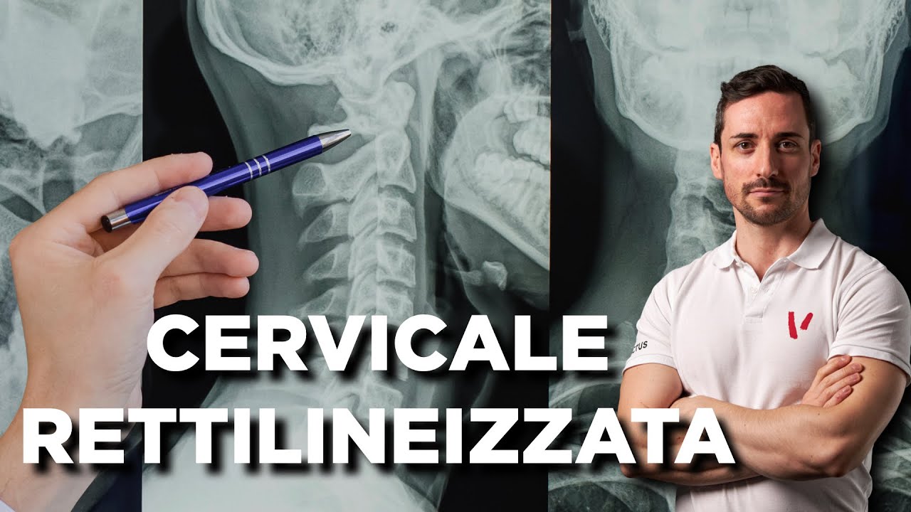 Cervicale rettilineaizzata - Cause, gestione e rimedi - YouTube