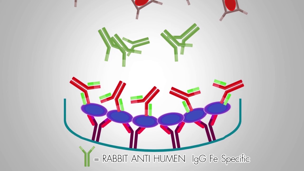 Detection of anti-platelet antibody_SPRCA_Thai - YouTube