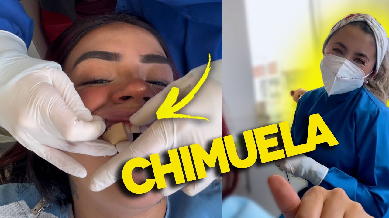 CASI me quedo CHIMUELA🦷 (Cambio de corona)😂 l Samantrux - YouTube