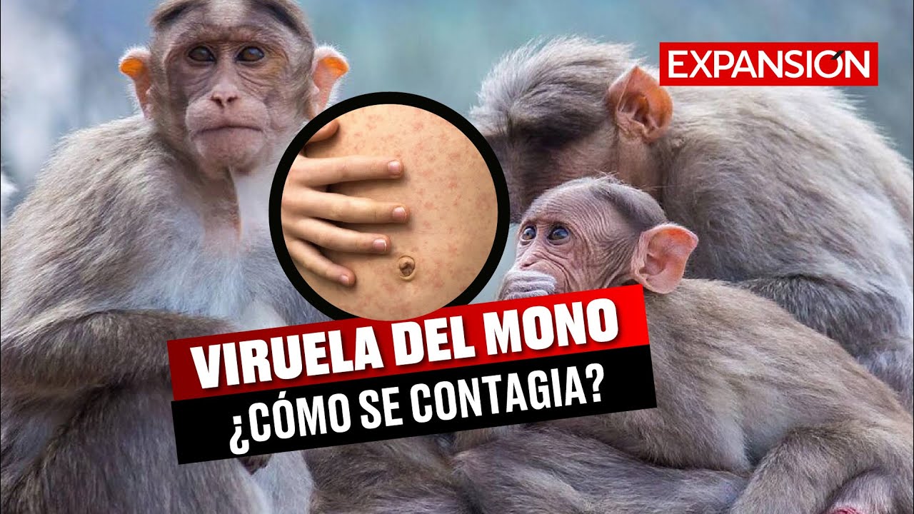 VIRUELA DEL MONO: Qué es, síntomas y cómo se contagia | ÚLTIMAS ...