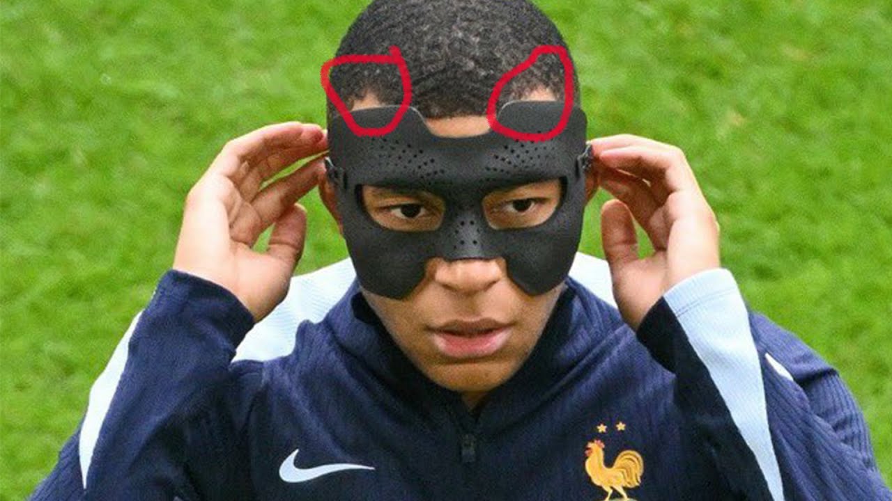 going bald at 25 is crazy - YouTube