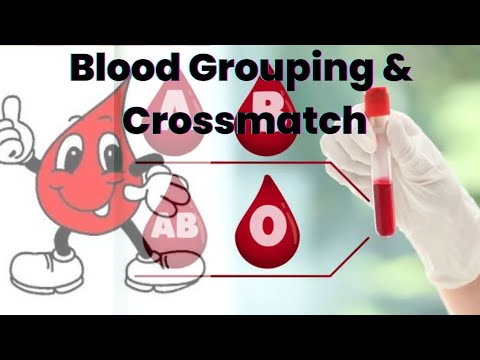 Blood Typing and Crossmatching | Blood Grouping | Blood Transfusions ...