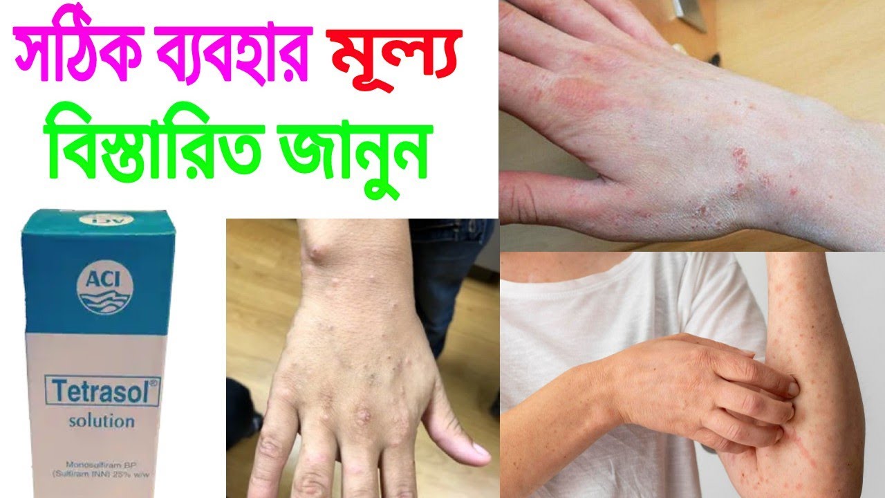 tetrasol এর কাজ কি? tetrasol solution full review Bangla. - YouTube