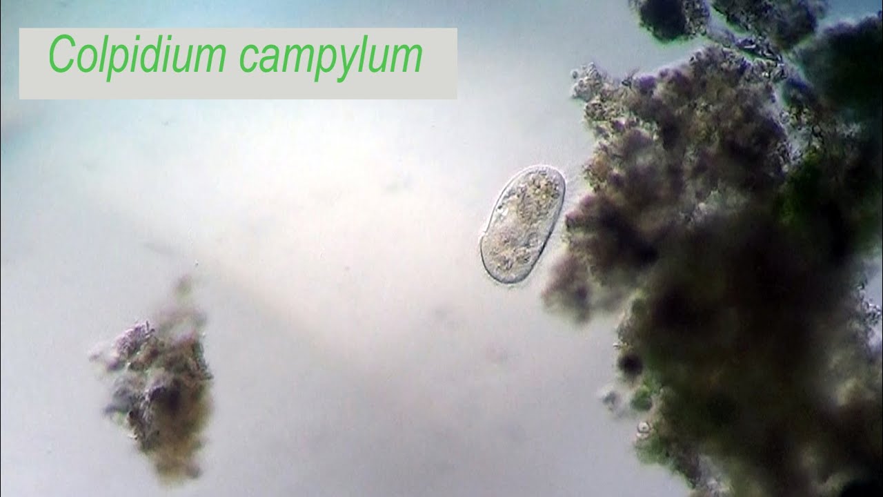 Colpidium campylum - YouTube