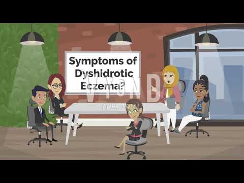 Dyshidrotic Eczema, causes, symptoms, and treatment. - YouTube