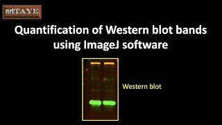 Quantification of western blot using imageJ for beginners | western blot quantification | imagej