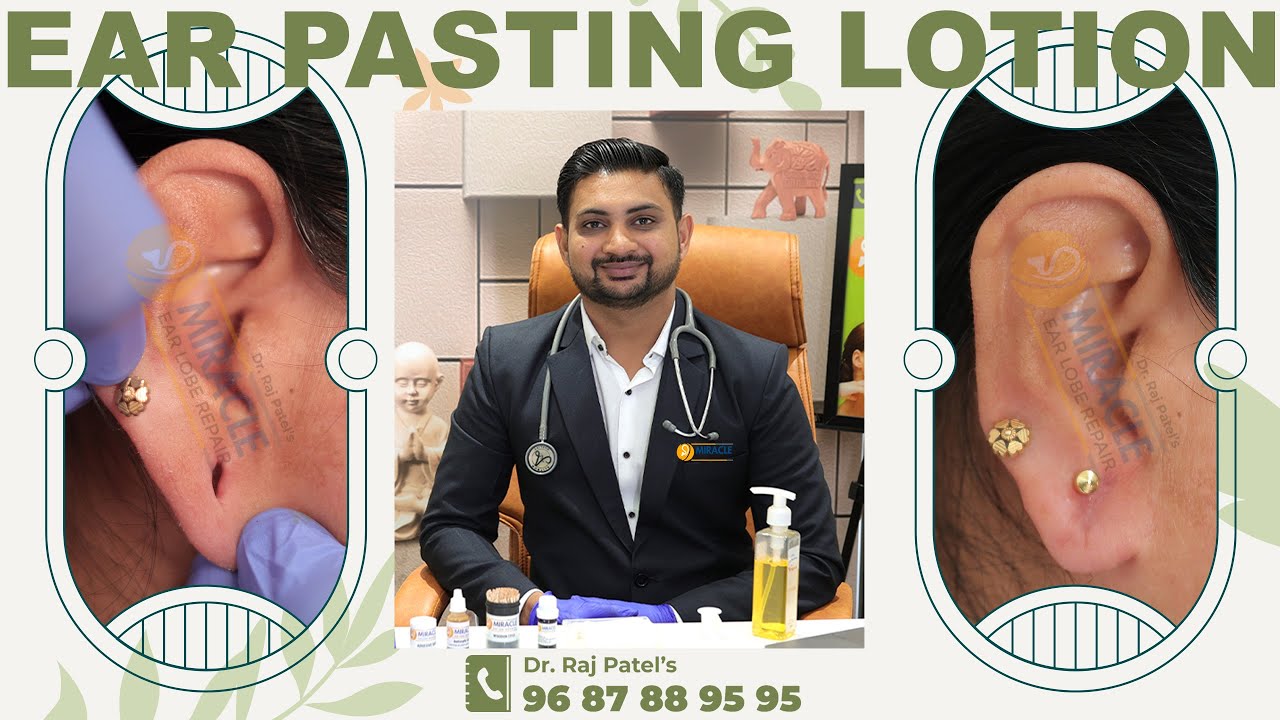 Ear lobe repair kaise kare👂👂 | ear pasting Treatment | कान के बढ़े हुए ...