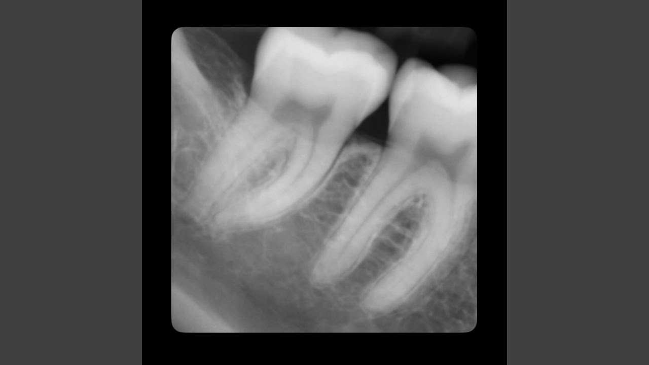 Teeth - YouTube Music
