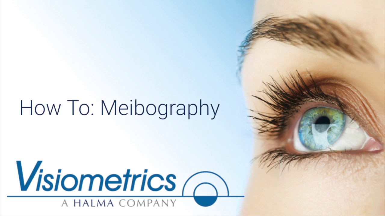 How To Take A Meibomian Gland Photo - YouTube