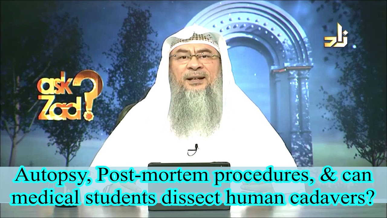 Autopsy, Post-Mortem procedure & Medical Students dissecting human ...