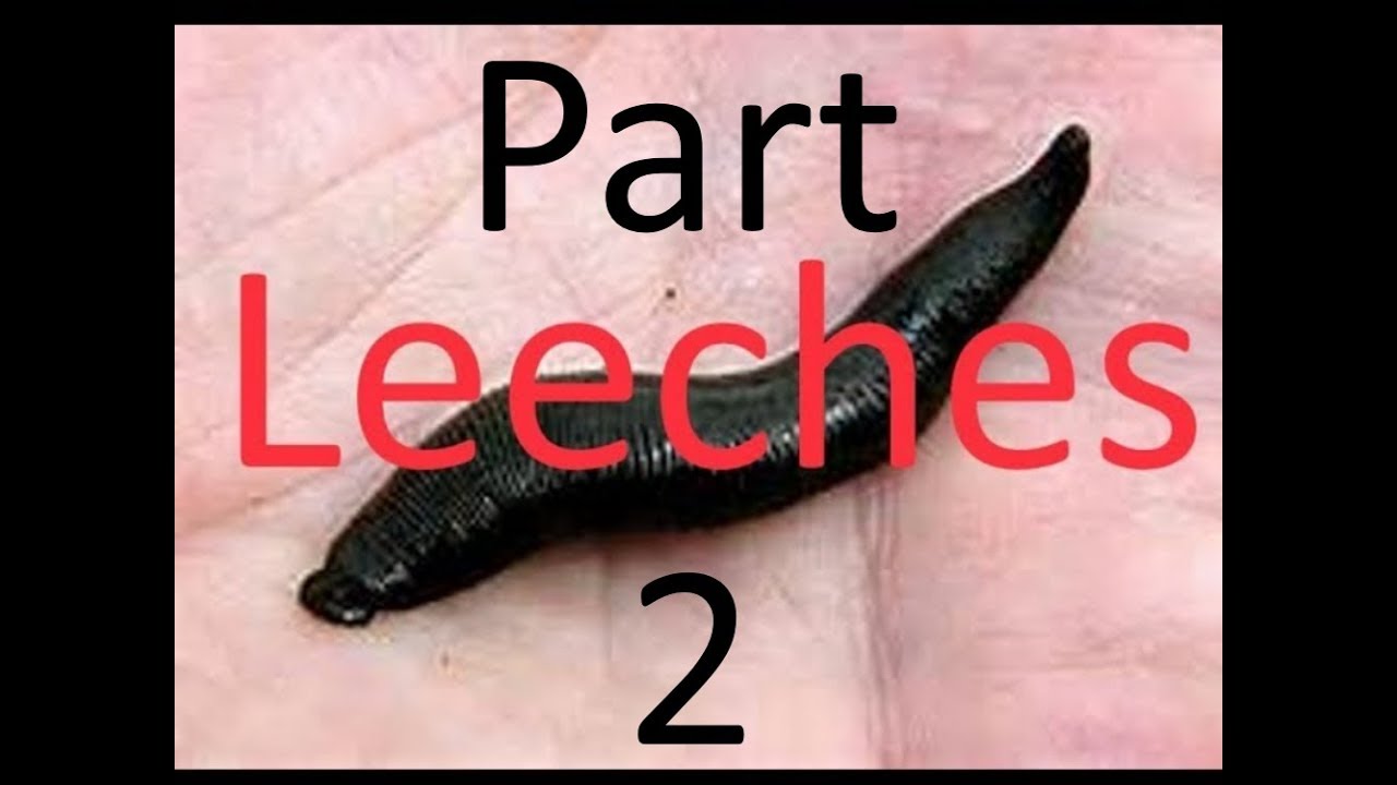 Easy killer leeches part 2 in HD - YouTube