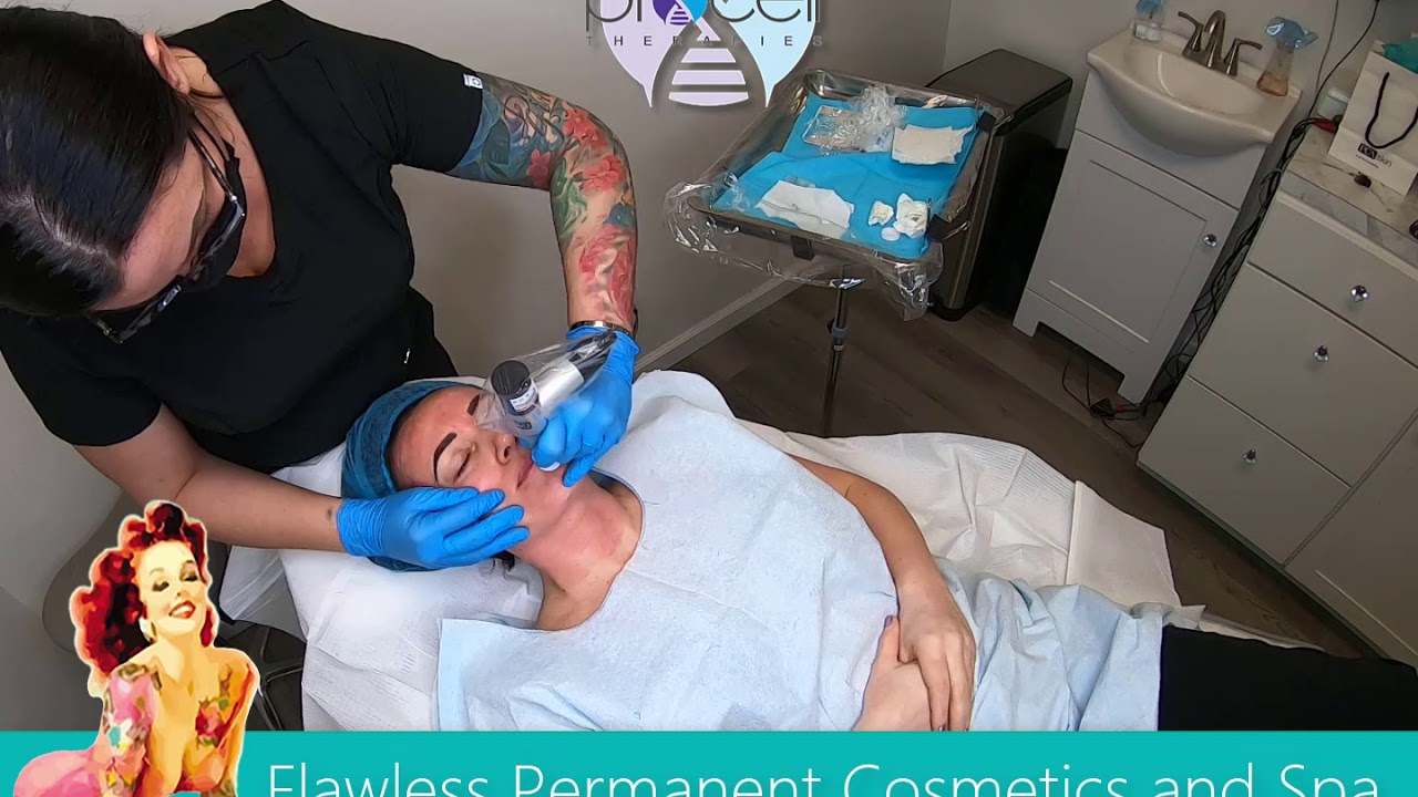 Vampire Facial with Procell Microchanneling By Angela - YouTube