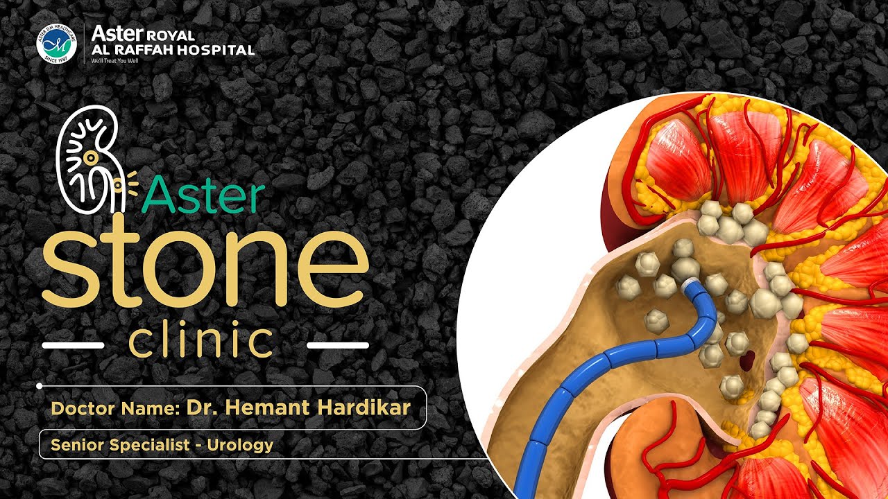 Aster Stone Clinic - Free First Consultation - Aster Al Raffah Hospitals & Clinics Oman - YouTube