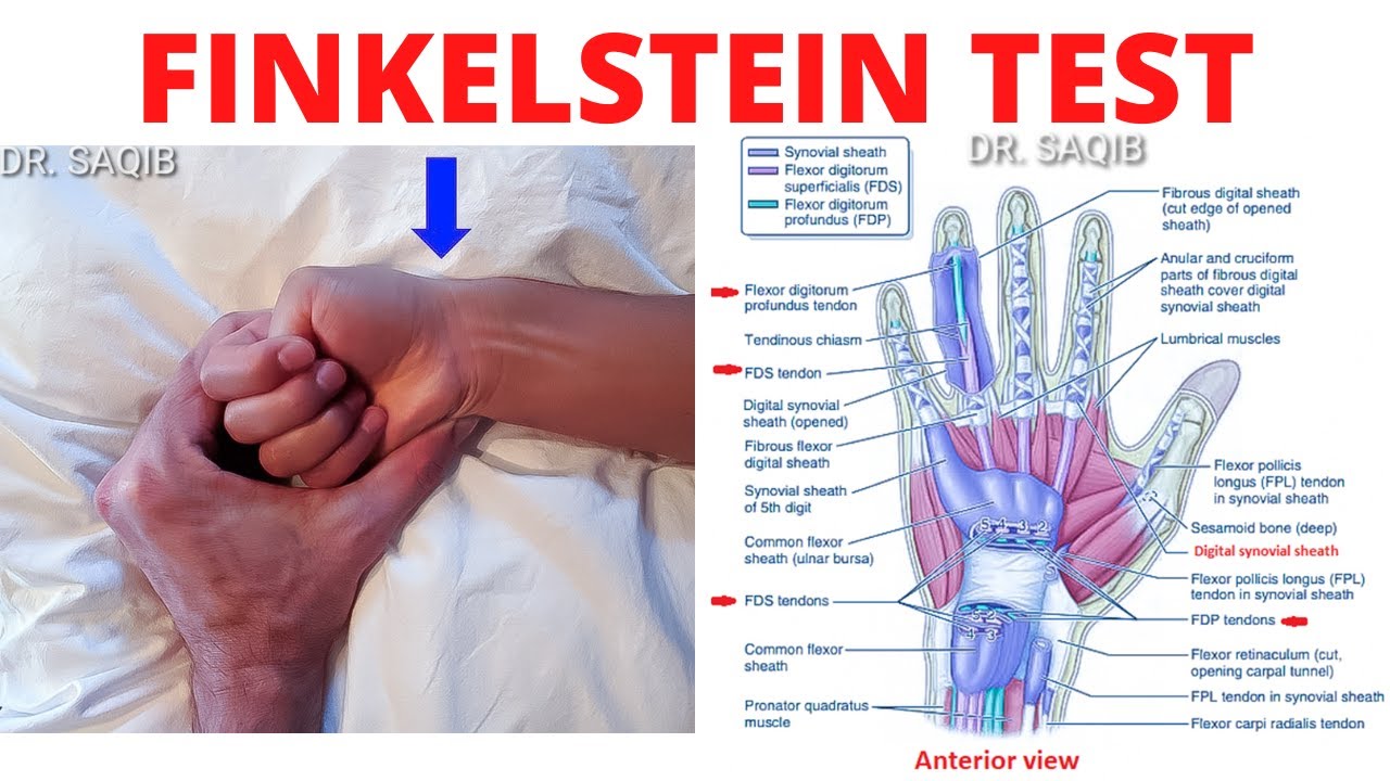 Finkelstein Test | De Quervain's Tenosynovitis | Everything You Need to ...