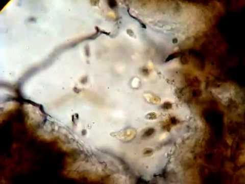 Protozoa in the intestines of termites by Zenter - YouTube