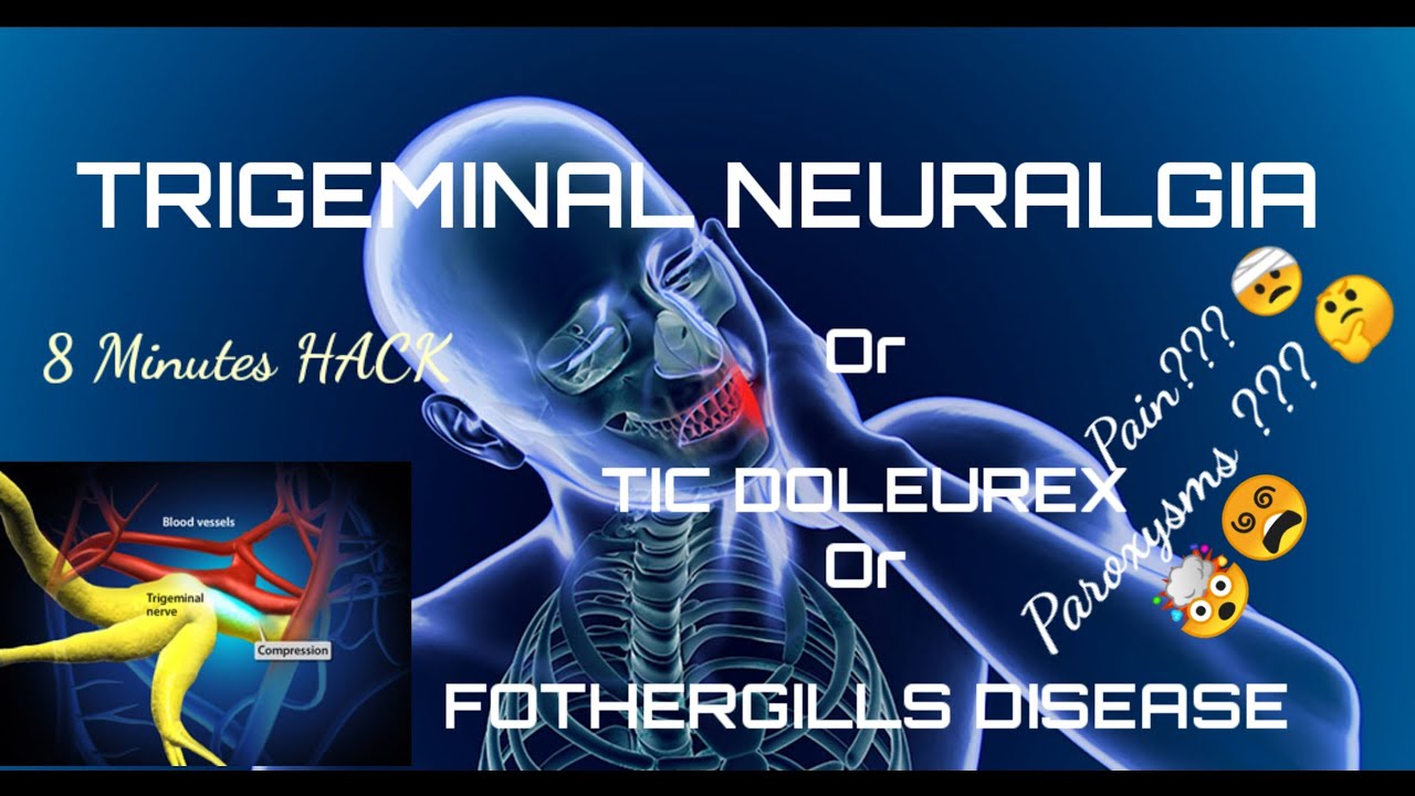 Trigeminal Neuralgia/ Fother gills Disese,/Tic Doleurex - YouTube