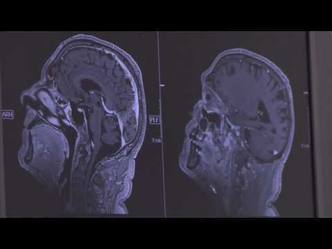 MRT-Video Studienzentrum Greifswald - NAKO