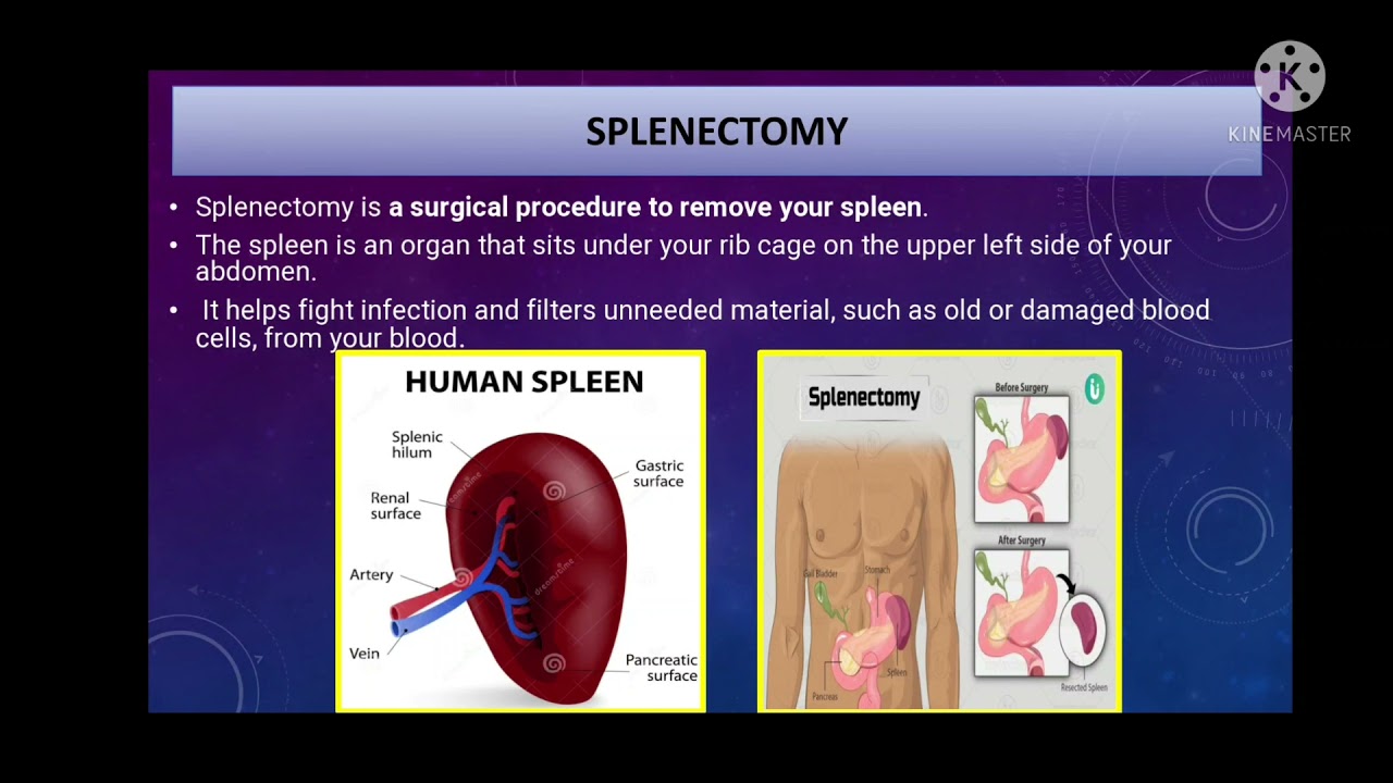 Sutures and Resection of Liver,Splenectomy, Cholecystectomy ...