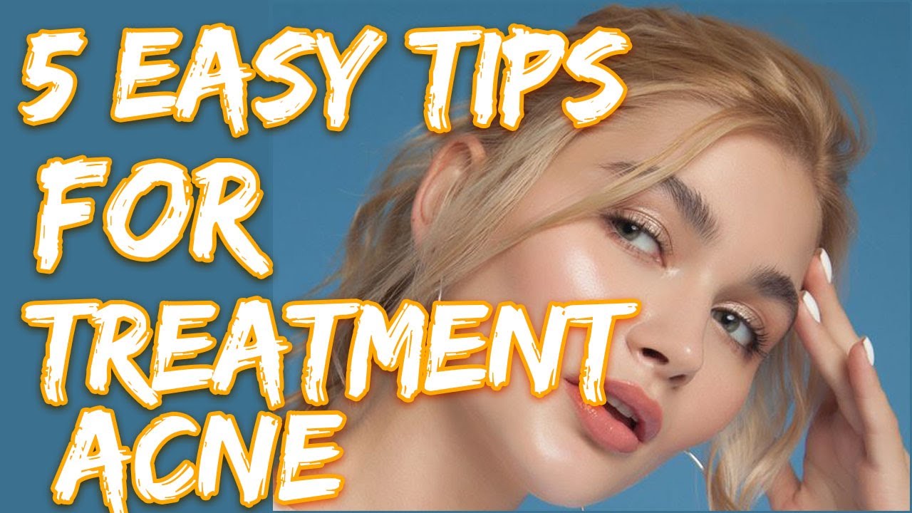 5 easy tips for treating acne || loan nguyen acne treatment || acne ...
