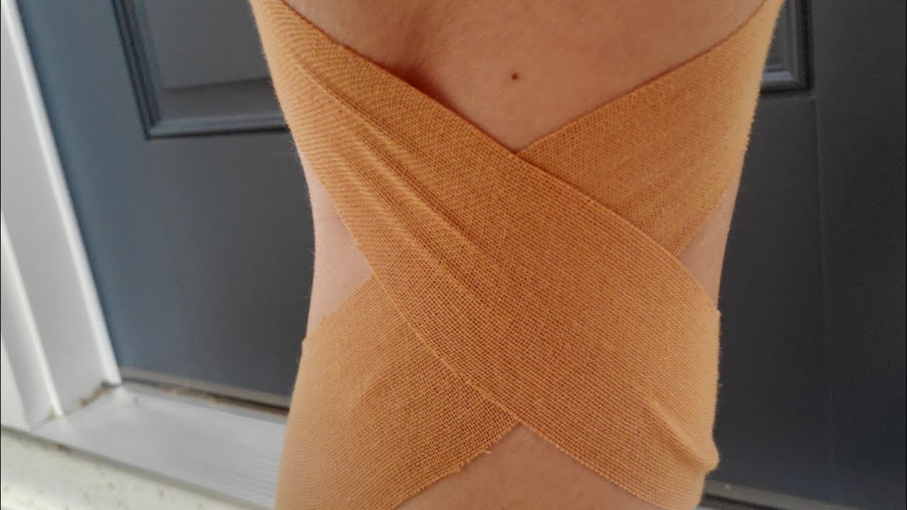 Baker's Cyst Kinesiotape for Comfort, Pain and Support from A Physical ...